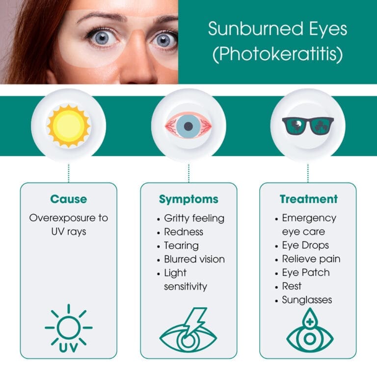 Photokeratitis Treatment NYC | Sunburn Eyes Treatment in Downtown Manhattan