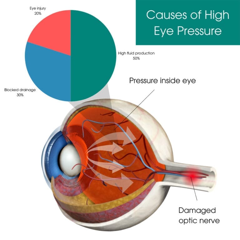 Eye Pressure Test (Tonometry) in Downtown Manhattan
